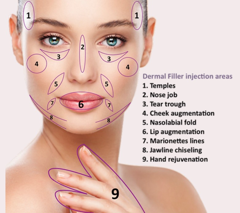 Dermal Filler Injections – Moon Tree Medspa